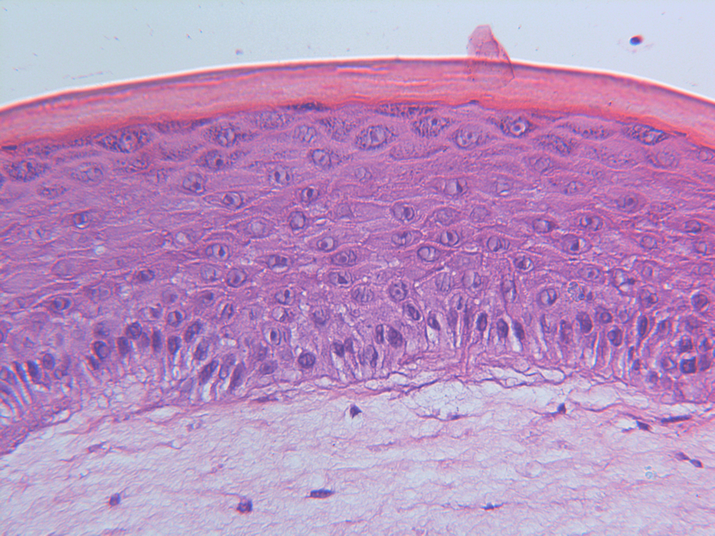 Μελέτη: Το τεχνητό ανθρώπινο δέρμα ανοίγει το δρόμο για νέες θεραπείες ...
